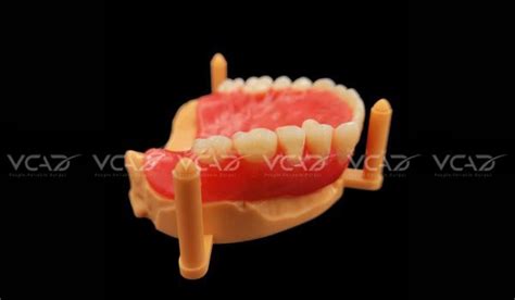 Case Study Best Upper Denture And Lower Partial Denture 2025
