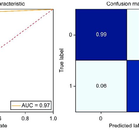 Pectus Excavatum Is Diagnosed By Haller Index 325 Calculation Of