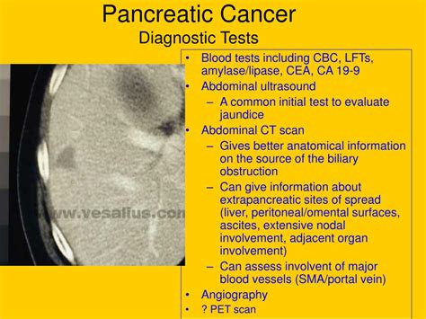 Ppt Periampullary And Pancreatic Tumors Powerpoint Presentation Free