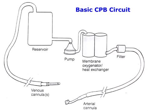 Extracorporeal Circulation Cpb Ecmo Ppt