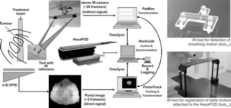 Figure 1 From Tumor Tracking And Motion Compensation With An Adaptive Tumor Tracking System