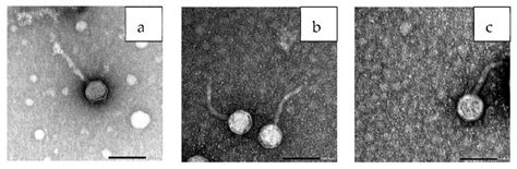Isolation Characterization And Genomic Analysis Of Three Novel E Coli Bacteriophages That