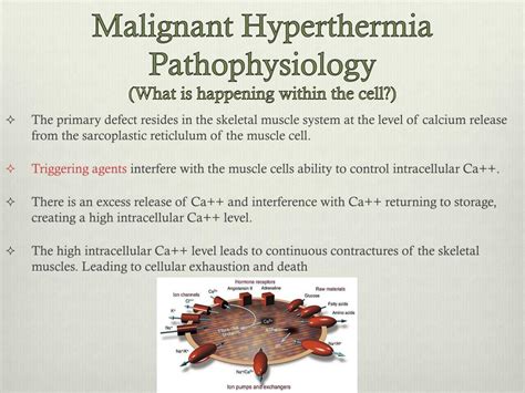 Hyperthermia Meaning
