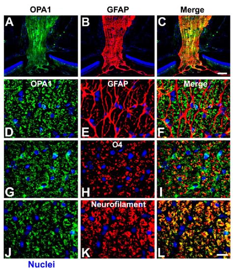 Opa1 Expression In The Normal Rat Retina And Optic Nerve Abstract