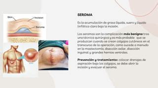 Complicaciones Quirúrgicas Más Frecuentes Pdf
