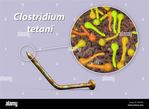 Transmission Of Tetanus Bacteria Conceptual Illustration Showing An Old Rusty Metal Nail As A