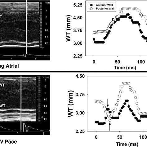 Representative M Mode Echocardiogram In A Mouse During Normal Sinus Download Scientific Diagram