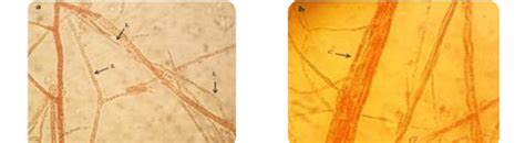 Pythium Ultimum Mycelium Lysis A And Formation Of Mycelial Cords B Download Scientific
