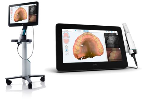 Itero Lumina Tm Pro Imaging System