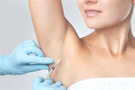 Botox For Hyperhidrosis