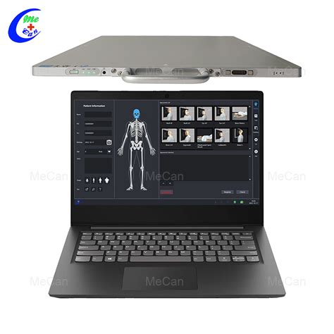 Flat Panel Detector Manufacturer Mecan Imaging Solutions