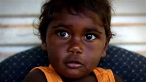 Why The Housing Shortage Exacerbates Scabies In Indigenous Communities