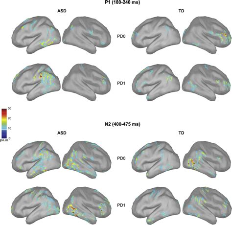 Cortical Sources Of The Weak Surround Suppression In Asd Cortical