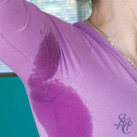 Sweat Reduction Treatment Hyperhidrosis Suffolk Medical And Beauty Clinic