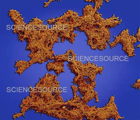 Streptococcus Gordonii Sem Stock Image Science Source Images
