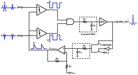 Low Noise Low Power Readout Ic For Two Electrode Ecg Recording Using Common Mode Charge Pump