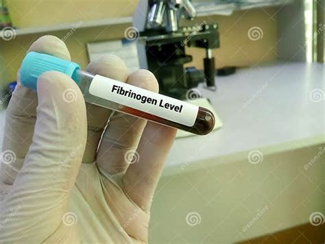 Fibrinogen Level Factor 1 Test Diagnosis Of Coagulation Disorder