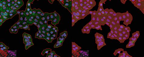 Separating Cell Boundaries In The Following Image And Also Do Nuclear Counting Using Python