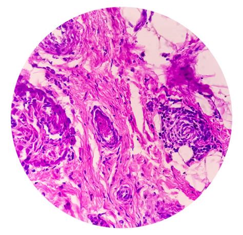 150개 이상의 거대세포 인간의 세포 이미지 스톡 사진 그림 및 Royalty Free 이미지 Istock