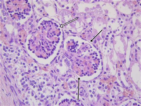 Glomerulus With Standard Podocyte Number White Arrow Glomerulus With Download Scientific