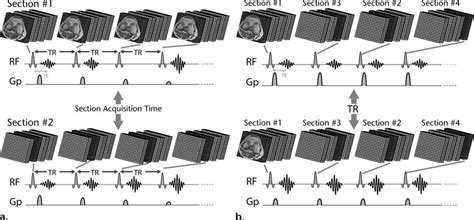 A Drawings Illustrate Single Section Technique In Which All Download Scientific Diagram