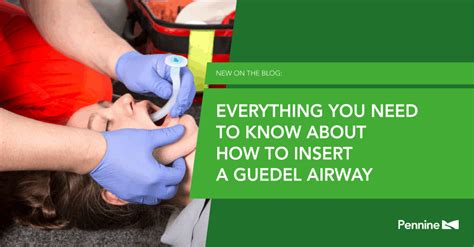 How To Treat Incomplete Bladder Emptying Insights From Nice Guidelines
