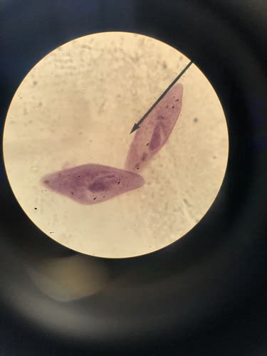 Potter Protists Lab Practical Slide Pictures Flashcards Quizlet