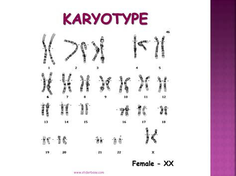 Karyotype