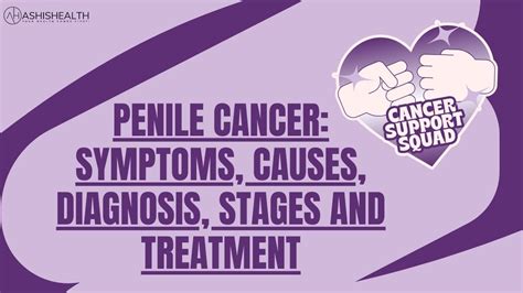 Penile Cancer Symptoms Diagnosis Stages And Treatment