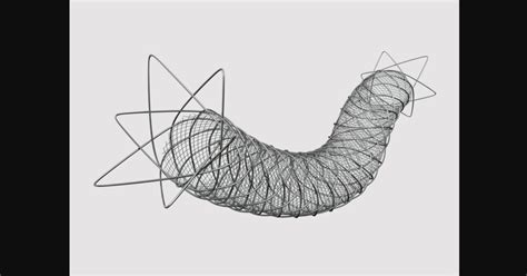 Terumo Interventional Systems Launches Dual Layer Micromesh Carotid