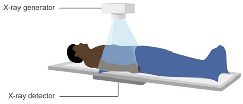 Abdominal Ct Planes • Litfl • Radiology Library