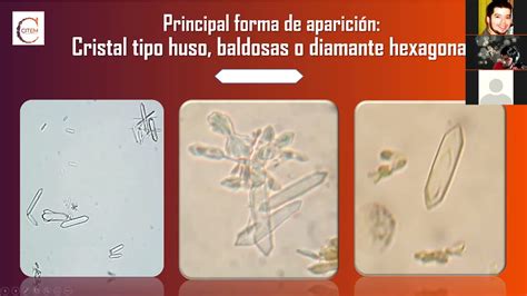 Aprende Y Conoce Los Cristales En Orina Menos Comunes 💎🧪 Youtube