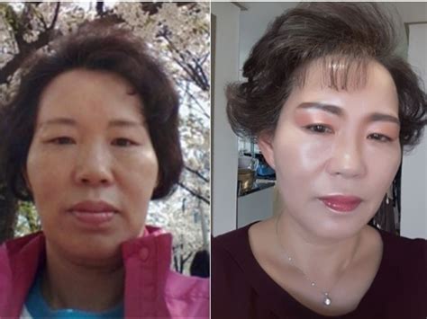 리영화장품 주름제거젊은아줌마성형맛사지법 공개 Band