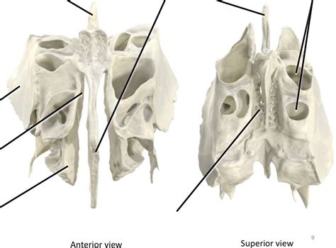 Ethmoid Diagram Quizlet