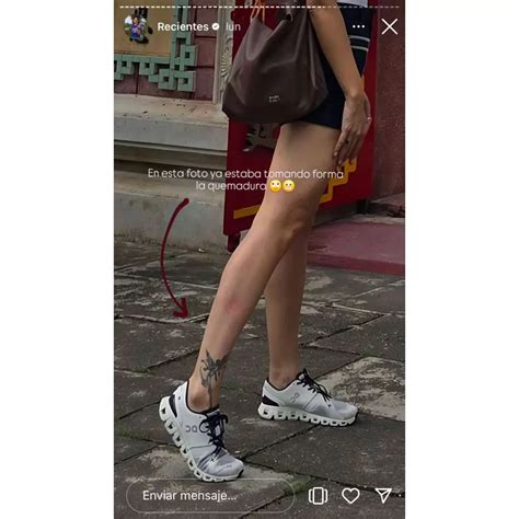 El Complejo Accidente Que Sufrió Kel Calderón En Su Viaje Por Vietnam