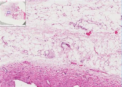 Exam 2 Histology Slides Flashcards Quizlet