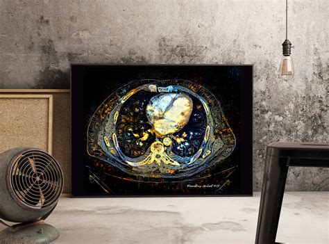 Chest Lung Pulmonary Art Canvas Anatomy Radiology Art Etsy