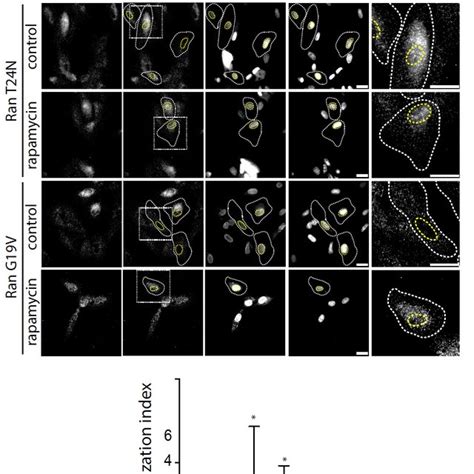 Rapamycin Induced Gsk3β Nuclear Localization Is Ran Dependent A Rpe