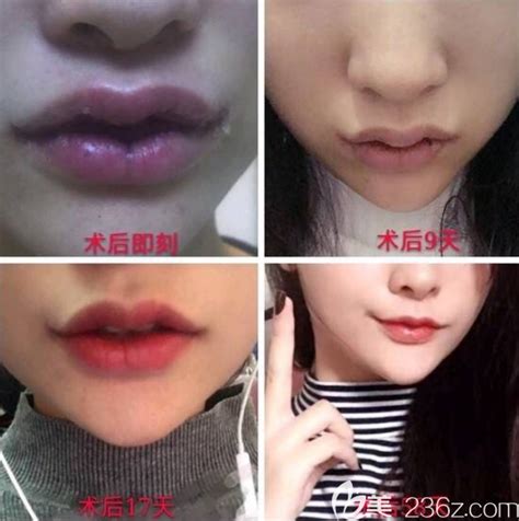 微笑唇图片前后 微笑唇图片 最美唇形 大山谷图库