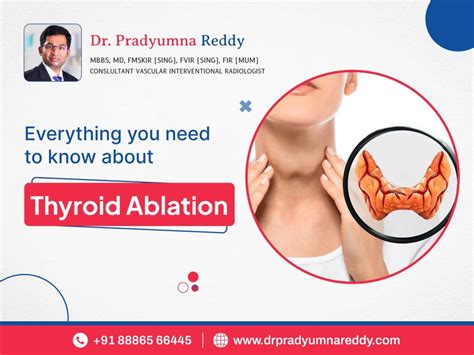 Everything You Need To Know About Thyroid Ablation Dr Pradyumna Reddy