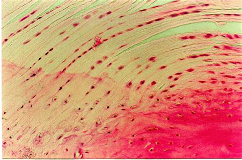 Fibrocartilage Histology