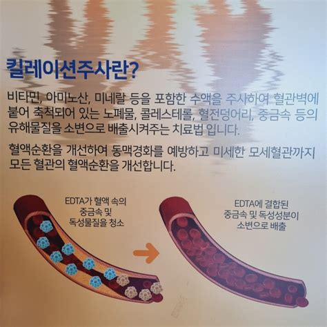 약물이 경동맥 죽상경화증을 개선할 수 있습니까 이슈칼럼