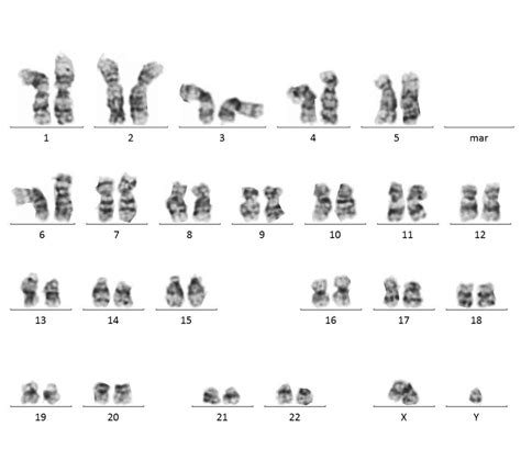 A A Metaphase Chromosome Image And B Corresponding Karyotype Image Download Scientific
