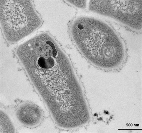 Rhodococcus Equi Flashcards Quizlet