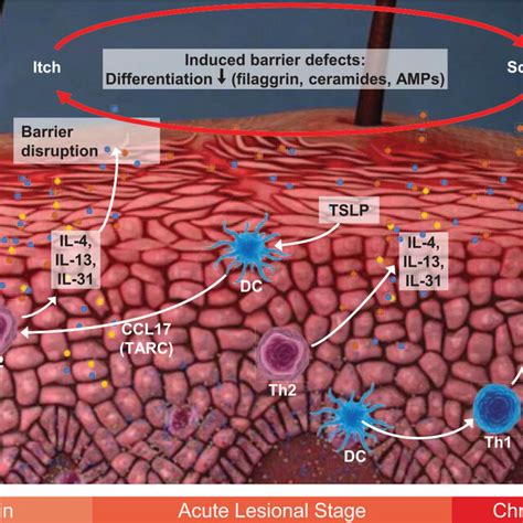 Pathophysiology Of Atopic Dermatitis A Nonlesional Skin With Download Scientific Diagram