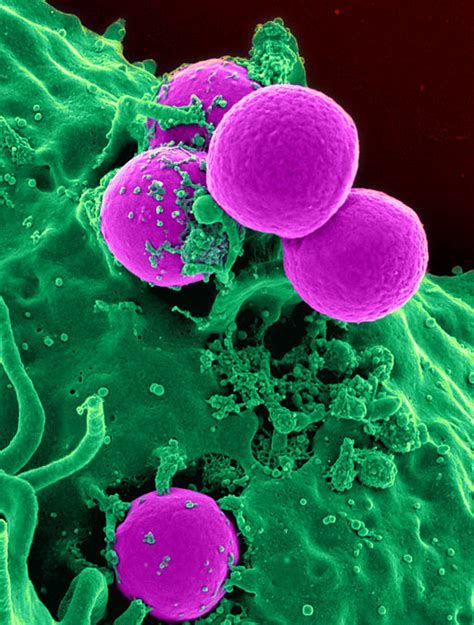 Common Bacillus Probiotic Can Eliminate Methicillin Resistant