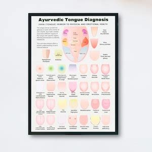 Ayurveda Tongue Diagnosis Chart Health And Wellness Art Digital