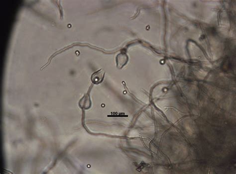 Phytophthora Ppo Home Washington State University