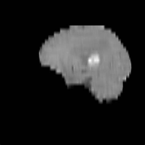 mmenendezg brain tumor object detection · datasets at hugging face