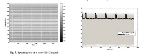 Spectrogram Of A Noisy Emg Signal Download Scientific Diagram
